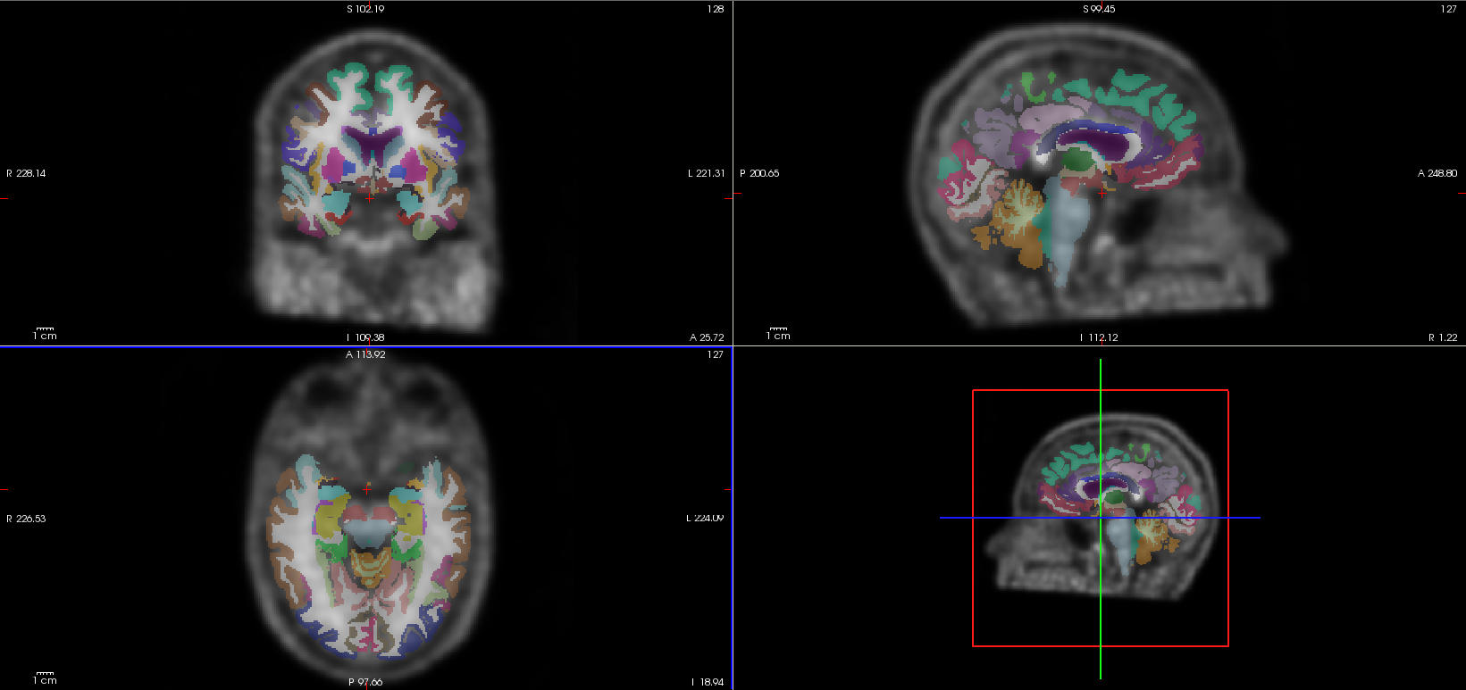PET Tutorial - VilleneuveLab Documentation