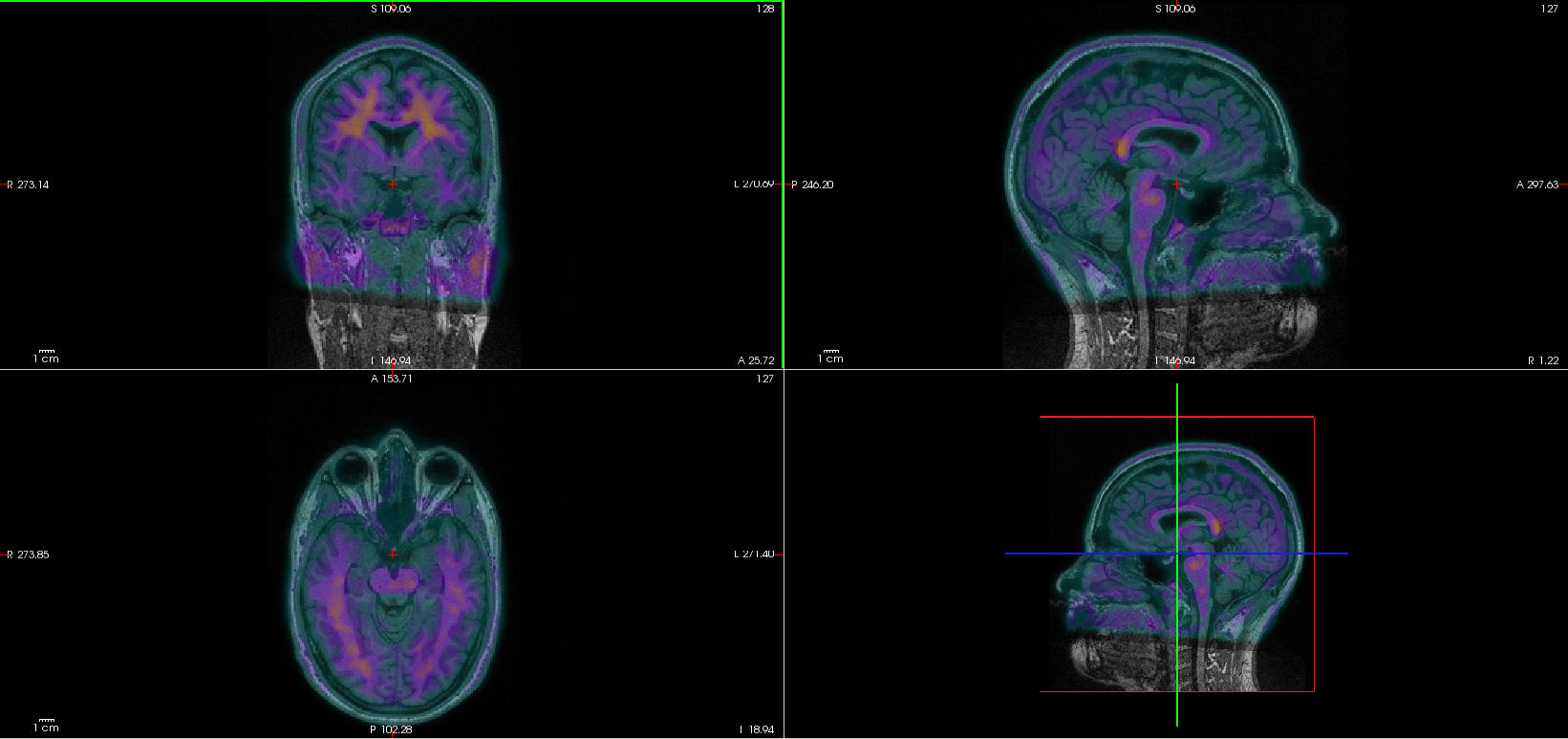PET Tutorial - VilleneuveLab Documentation