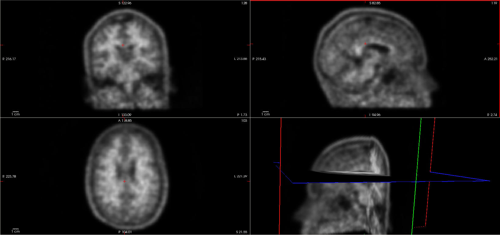 PET Tutorial - VilleneuveLab Documentation